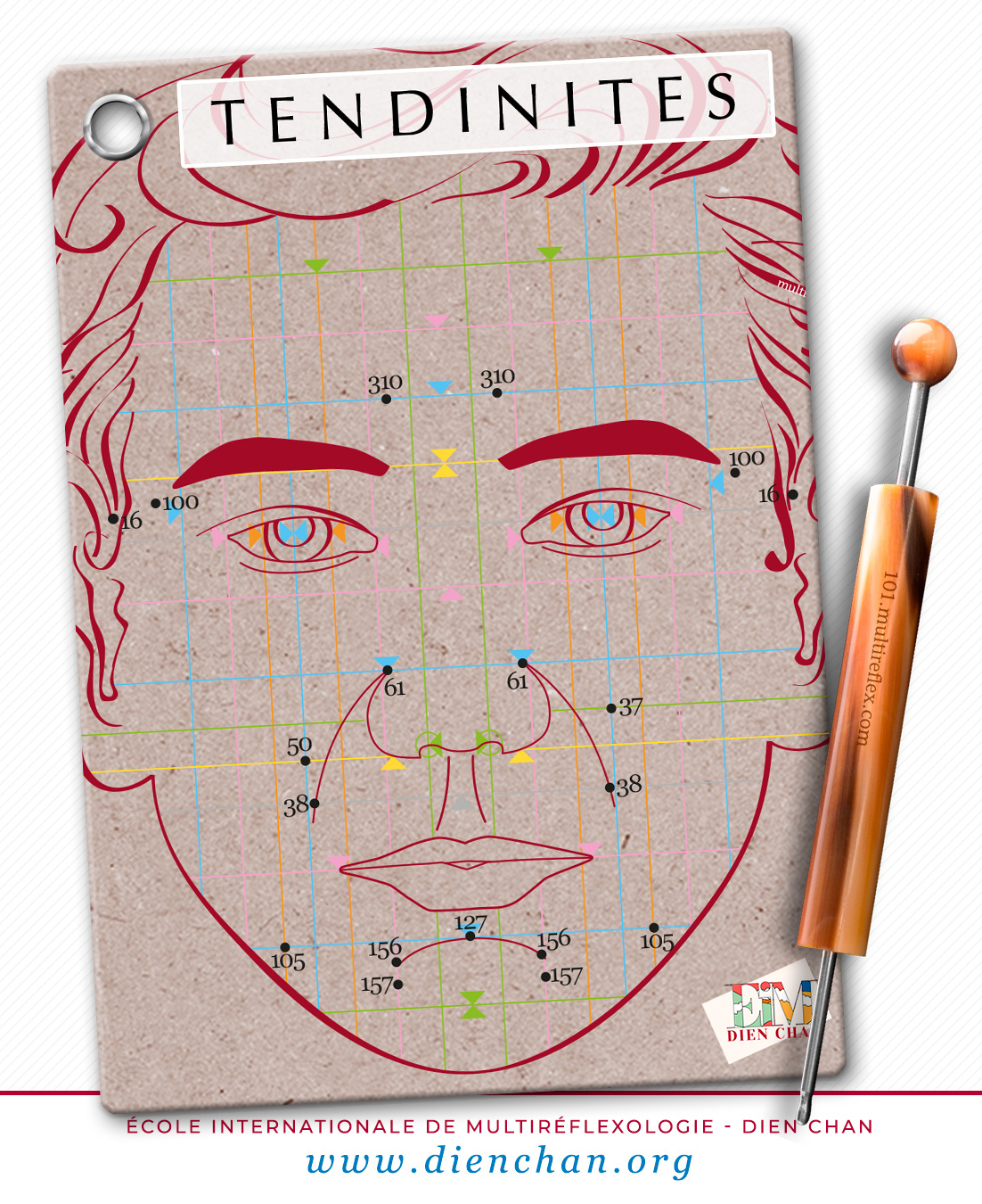 Tendinites - Les experts du Dien Chan